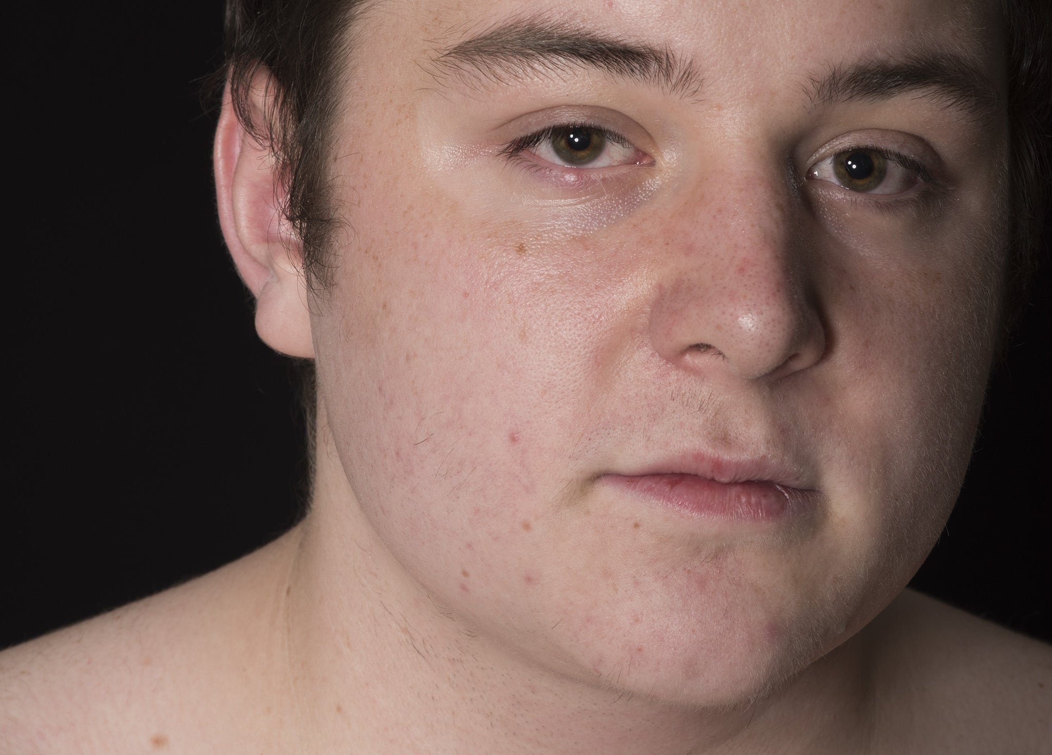 Male Face 20s FullFace #28 – Texturing.xyz