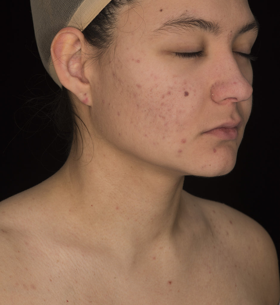 Female Face 20s FullFace #23 – Texturing.xyz