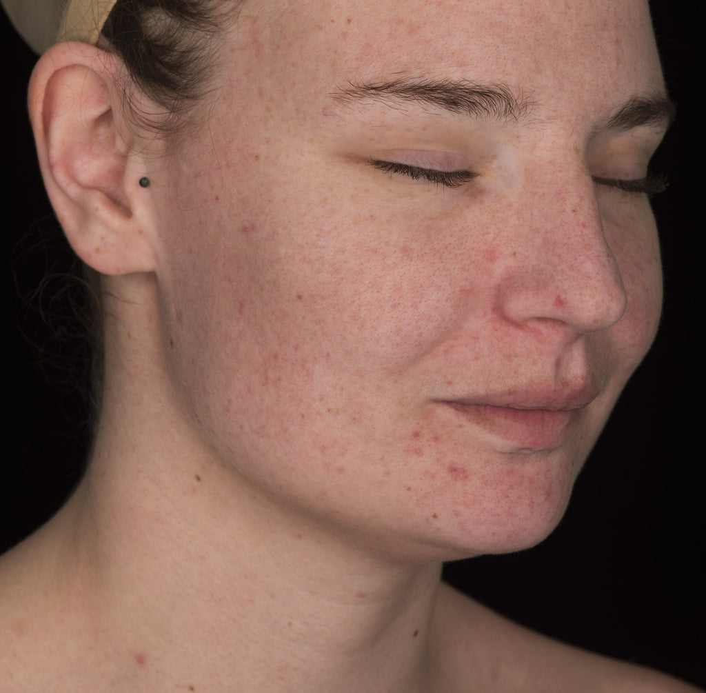 Female Face 20s FullFace #43 – Texturing.xyz